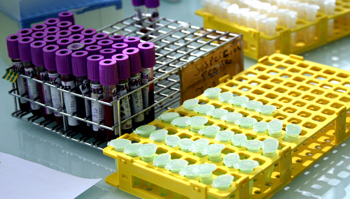 Laboratoire Analyses Creuse - Immuno-sérologie